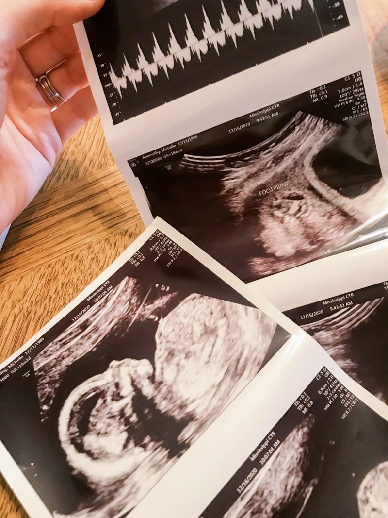 Second Trimester Pregnancy Recap | My Bump, Anatomy Scan, & More